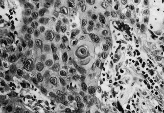ASTEREOGNOSIA - Binipatia e higienismo