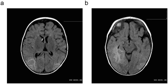 BALISMO - Binipatia e higienismo