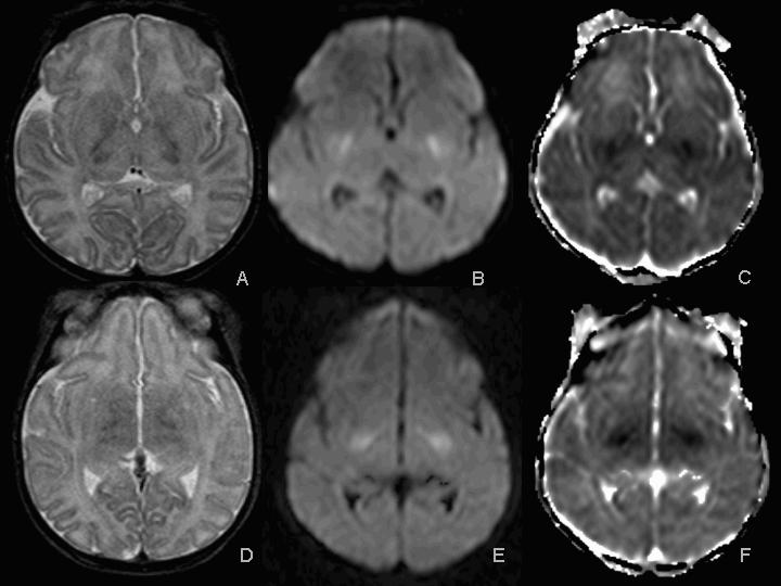 ARREFLEXIA - Binipatia e higienismo