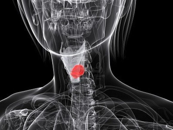 TUMORES MALIGNOS DE LA LARINGE - Binipatia e higienismo