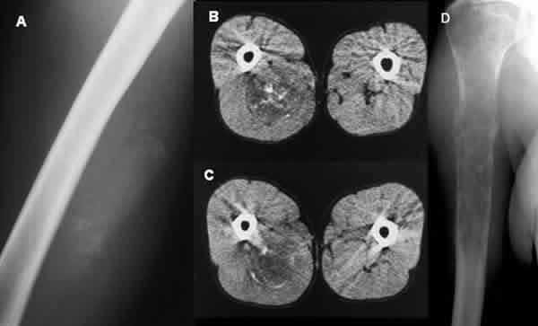 ANETODERMIA - Binipatia e higienismo
