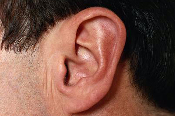 CARCINOMA BASOCELULAR DEL OIDO - Binipatia e higienismo